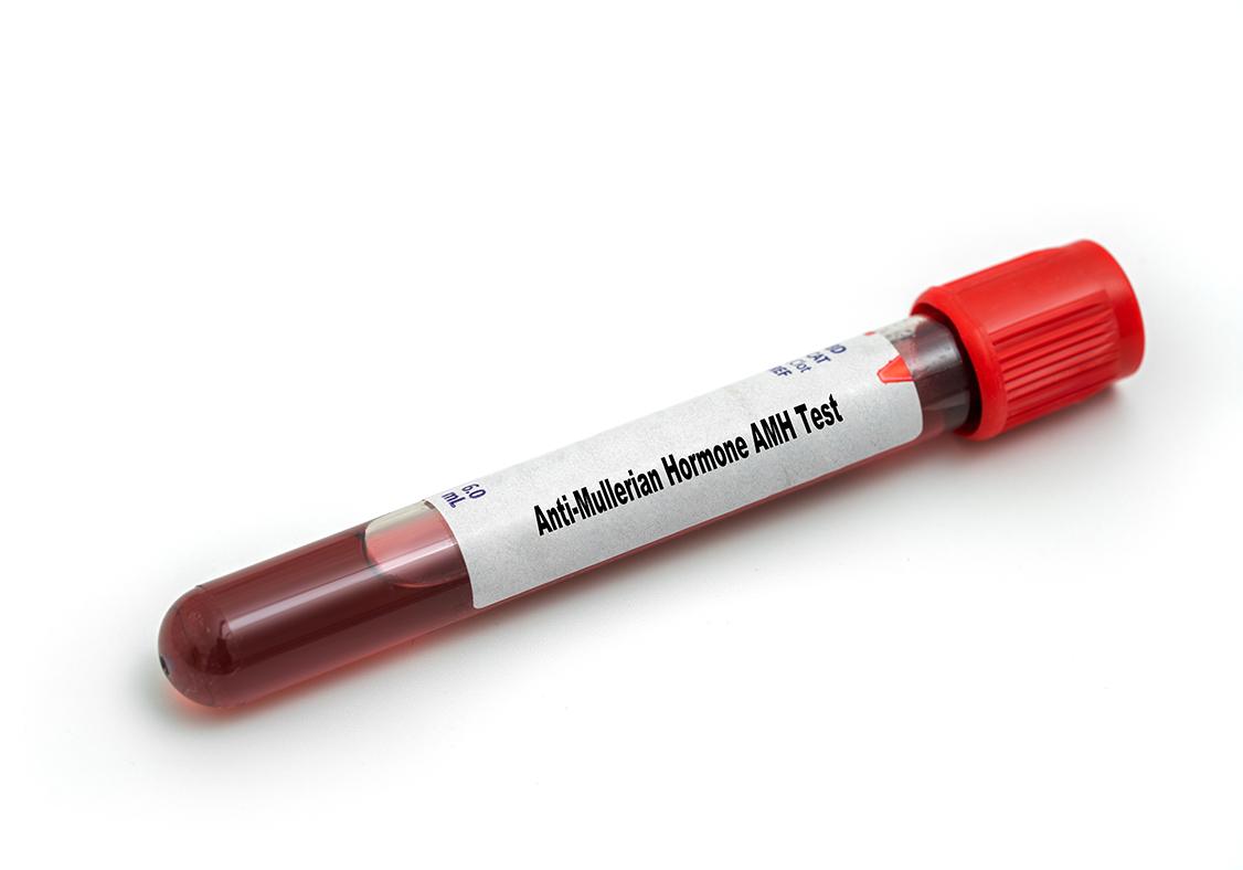 Why AHM is important - Segova